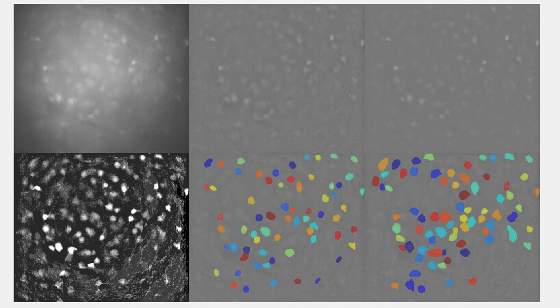 Stardist 2D doesn't detect/segment round objects in my image - Image Analysis - Image.sc Forum