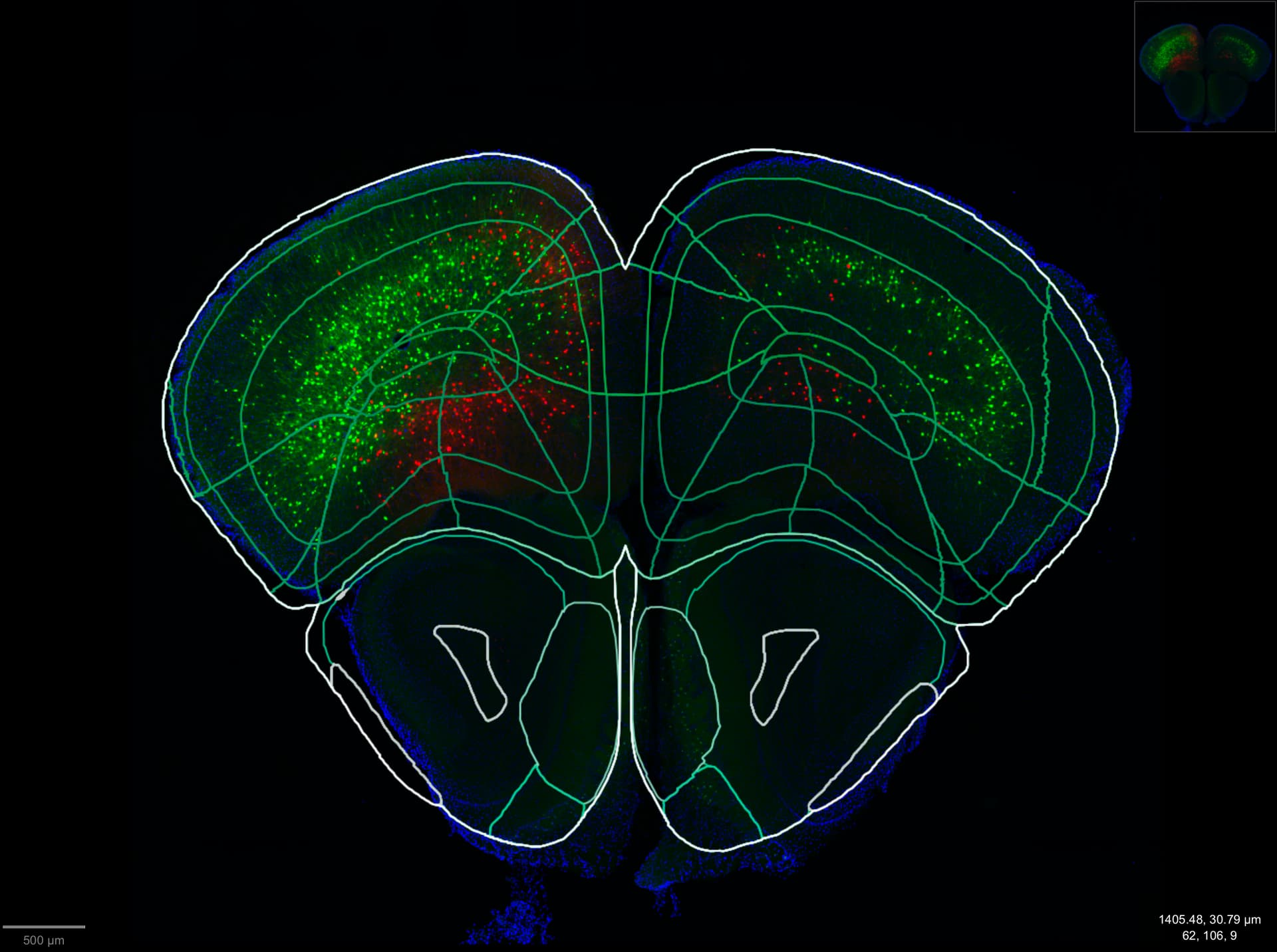 Issue with ABBA brain atlas registration to QuPath cell detection pipeline: detected cells won't ...