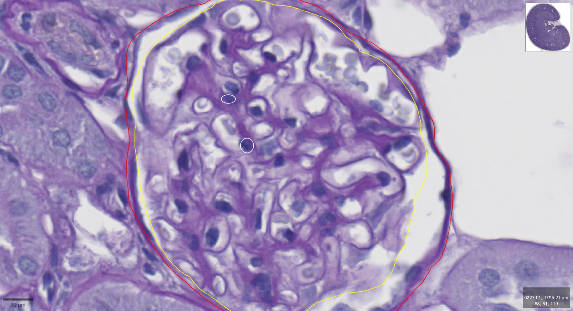QuPath Spatial Analysis between Kidney Glomerulus Nuclei - Image ...