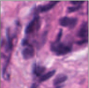 Detection of tiling artifact in H&E whole slide image - Image Analysis - Image.sc Forum