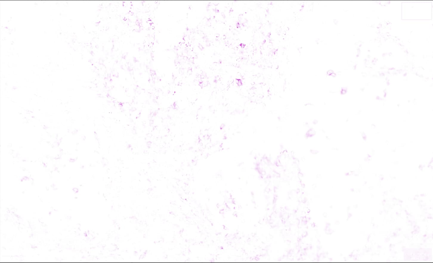 Creating Multiple Stain Vectors In Qupath With A Brightfield H Dab