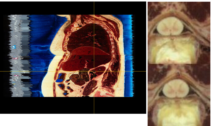 Stack Align Cryosection Images from the visible human project in FIJI - Image Analysis - Image ...