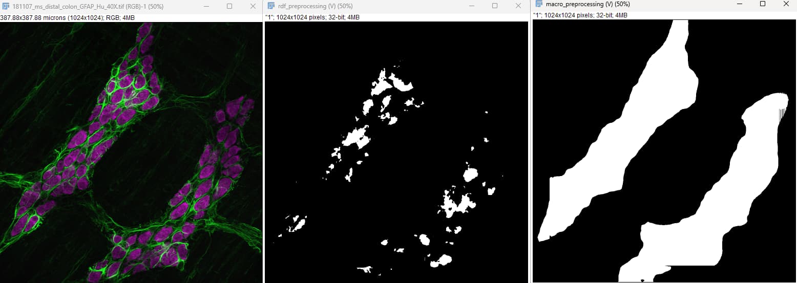 Bioimageio preprocessing question - Usage & Issues - Image.sc Forum