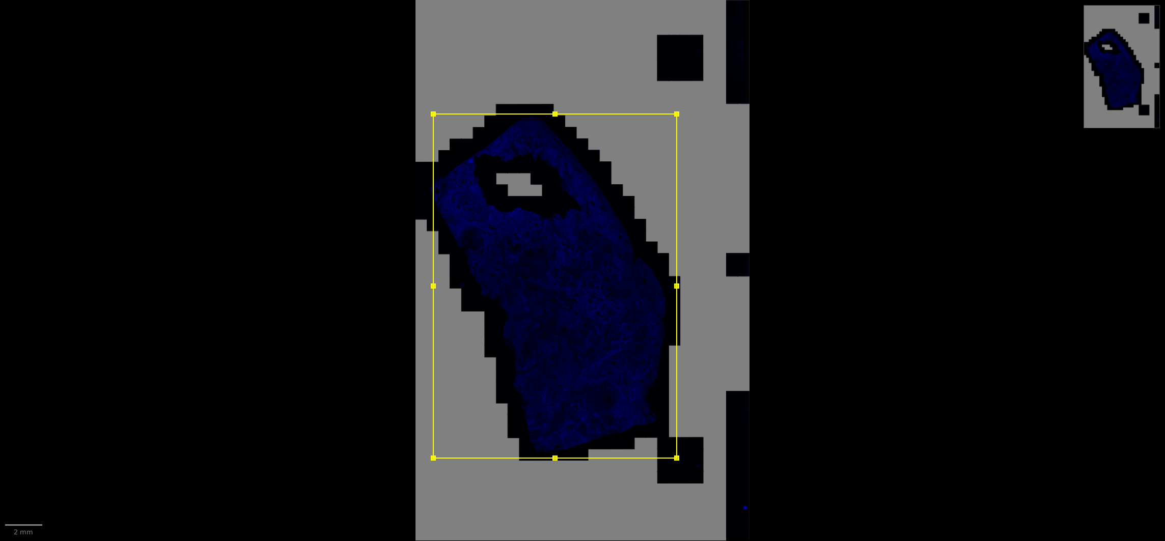 Fluorescence WSI Processing Issue: Handling Multiple Background Colors ...