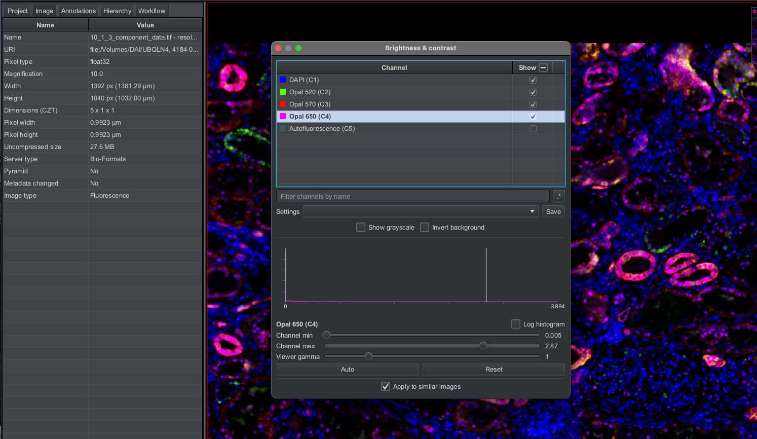 QuPath - About Channel Change - Image Analysis - Image.sc Forum