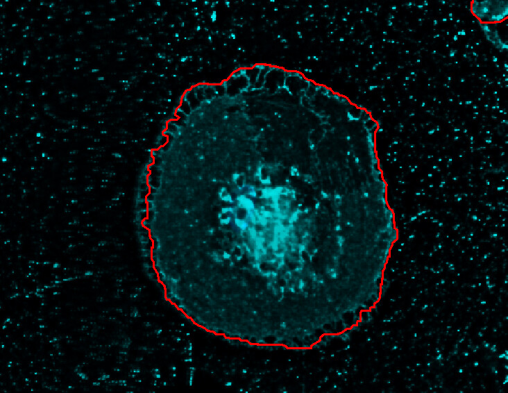 Segmenting multinucleated cells - Image Analysis - Image.sc Forum