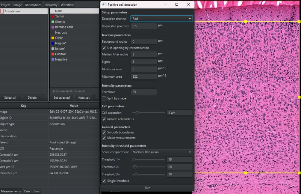 QuPath "Positive Cell Detection" not working for Rendered RGB - Image Analysis - Image.sc Forum