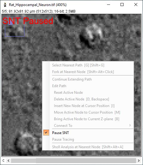 Zooming Issues when Using SNT - Usage & Issues - Image.sc Forum