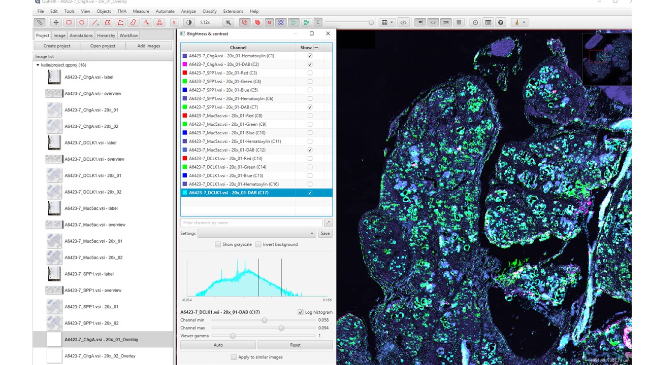 Using vsi for multiplex - how to get single channels in qupath - Image Analysis - Image.sc Forum