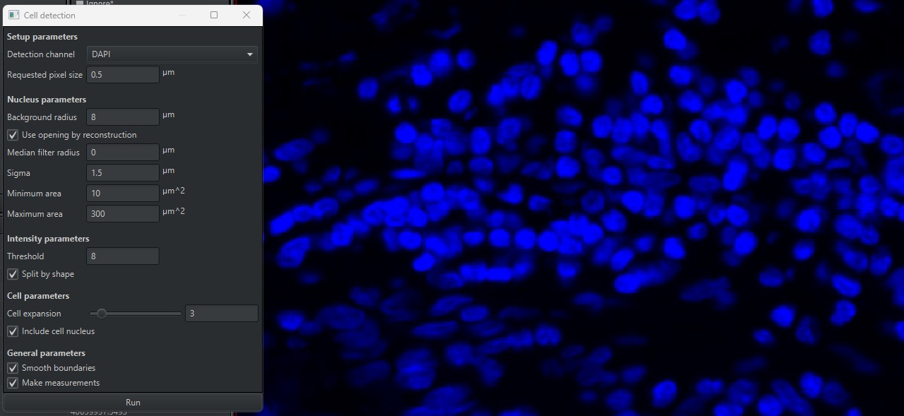 Qupath cell detection nuclei segregation - Image Analysis - Image.sc Forum