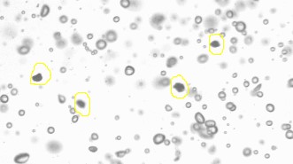 Separate solid and bubbles in fiji or imagej - Image Analysis - Image.sc Forum