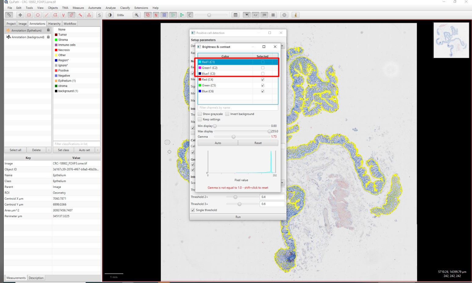 QuPath error when try to count positive cells - Usage & Issues - Image.sc Forum