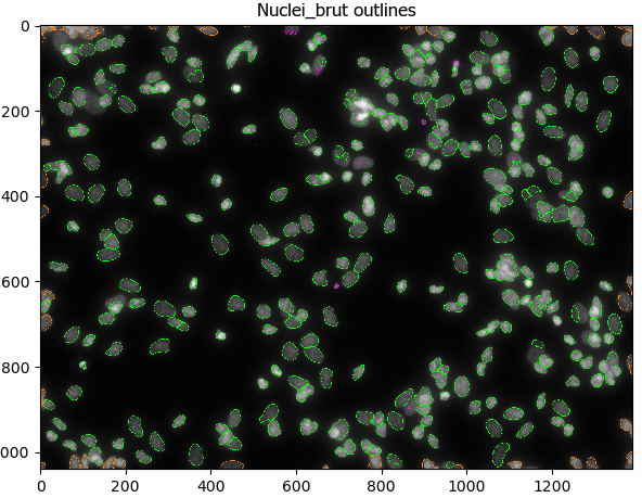 Cell Profiler image segmentation - Image Analysis - Image.sc Forum