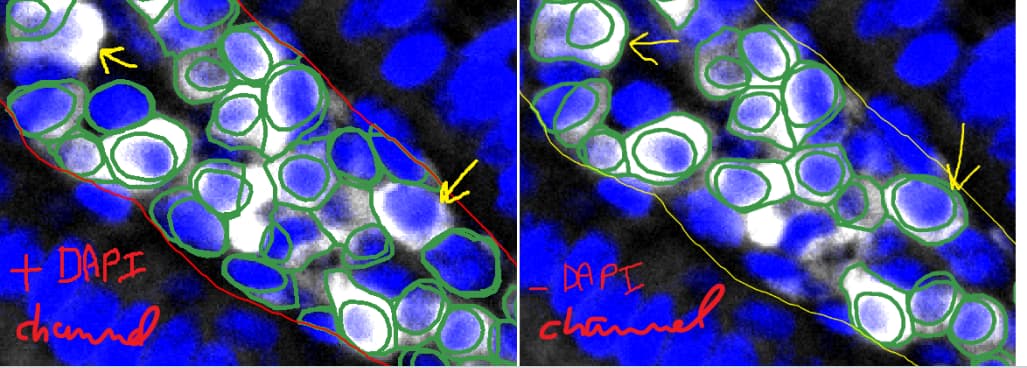 QuPath - Cellpose - Cell objects - Usage & Issues - Image.sc Forum
