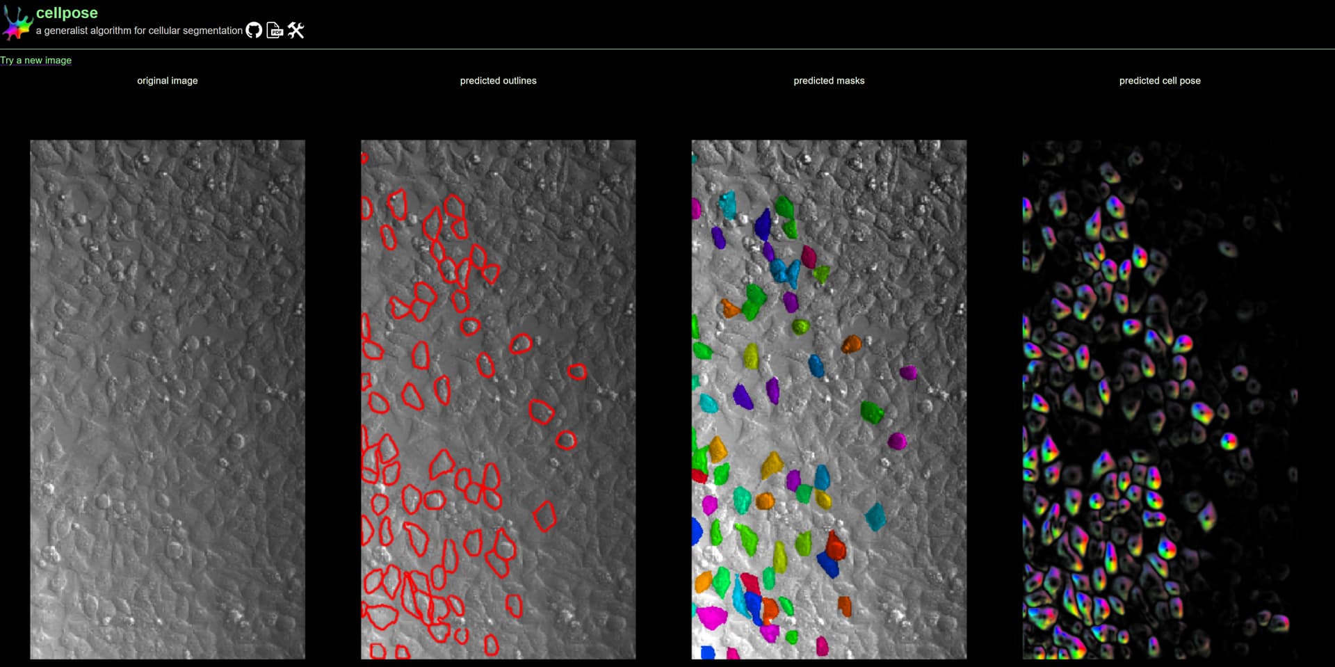 Counting cells within brightfield images - Image Analysis - Image.sc Forum