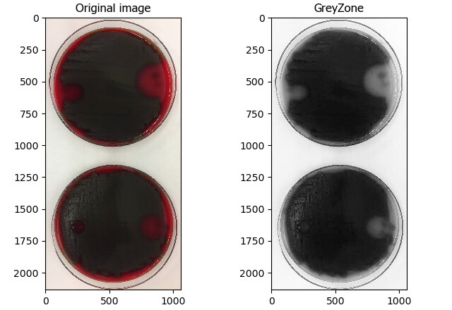 Trying to identify zones of inhibition using IdentifyPrimaryObjects - Development - Image.sc Forum