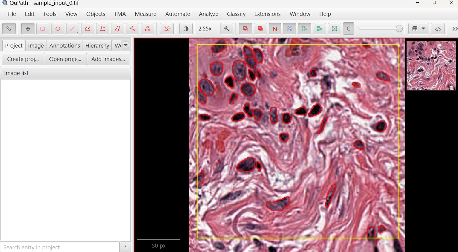 How to load InstanSeg model in QuPath - Usage & Issues - Image.sc Forum