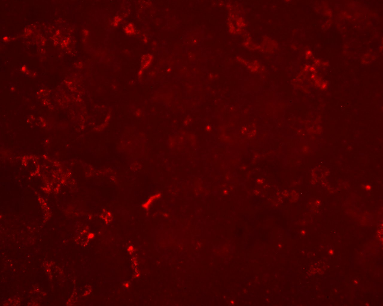 How to analyze the particle in imageJ using 2 different channel - Image Analysis - Image.sc Forum