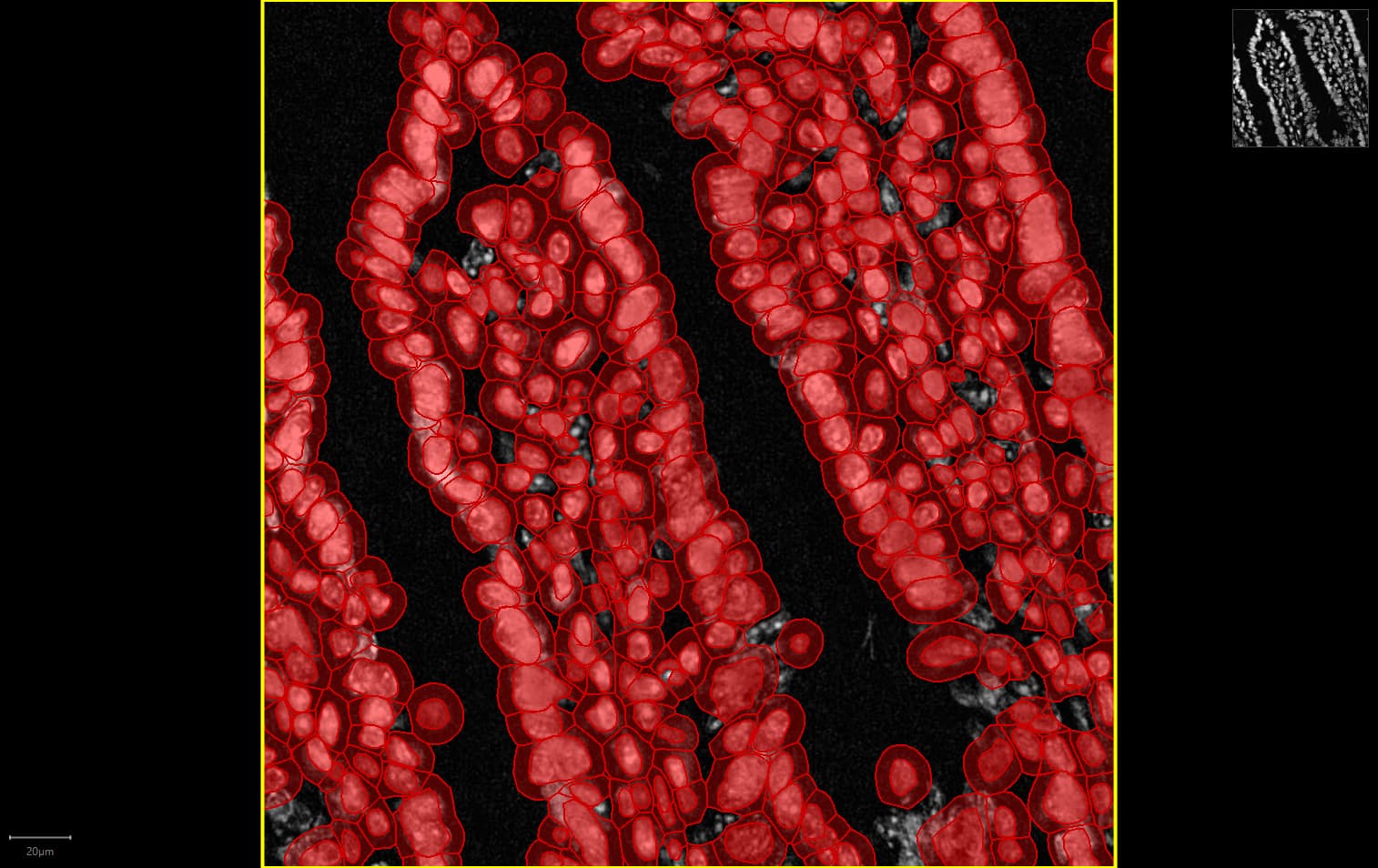 Dapi channel image adjustment/ cell segmentation - Image Analysis - Image.sc Forum