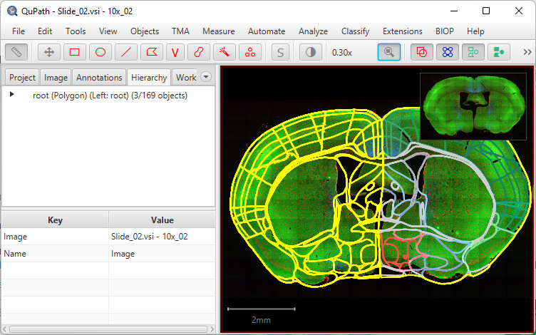 QuPath script to restrict cell detection to several sub-regions of the brain - Image Analysis ...