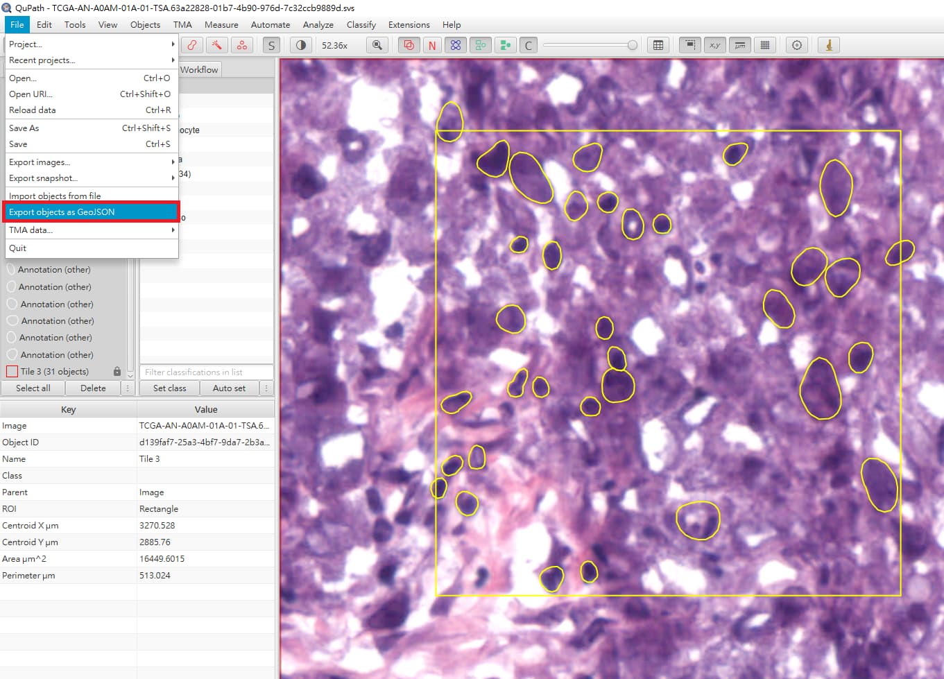 The issue about importing GeoJSON file to patch - Usage & Issues - Image.sc Forum