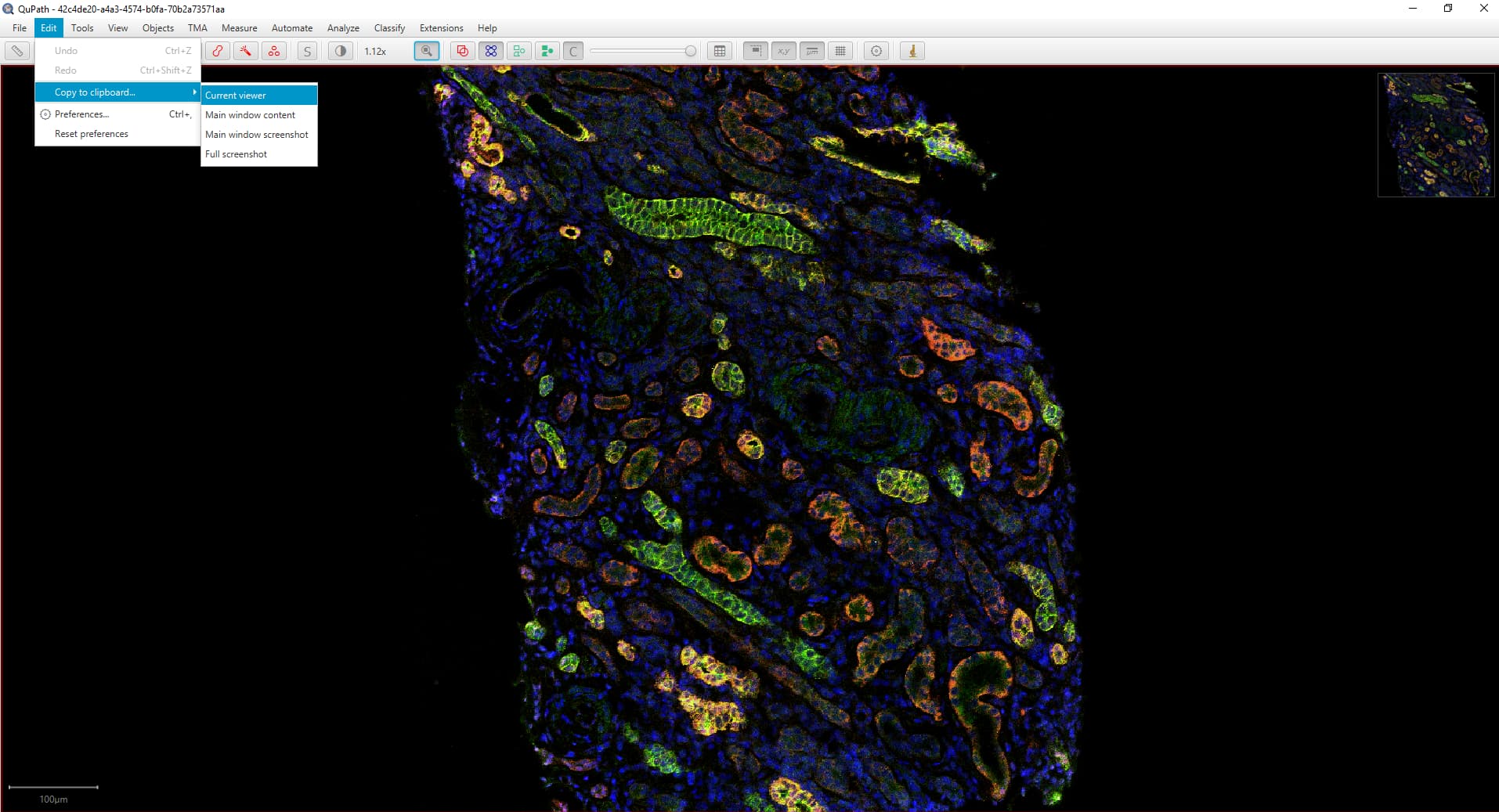 Exporting a multichannel image with scale bar in Qupath or Fiji? - Image Analysis - Image.sc Forum
