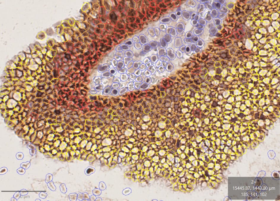 Intensity of staining in QuPath - Image Analysis - Image.sc Forum