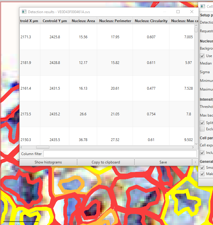 Nuclear size accuracy on qupath - Image Analysis - Image.sc Forum