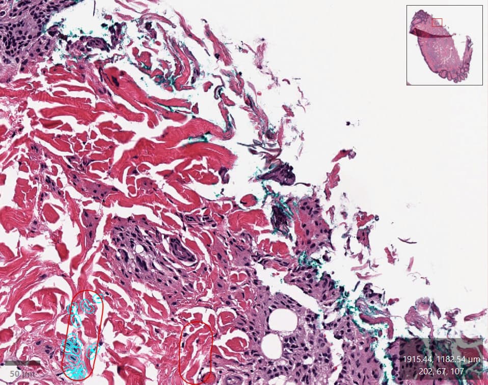 Exporting Images With Scalebar In Qupath Usage And Issues Imagesc Forum