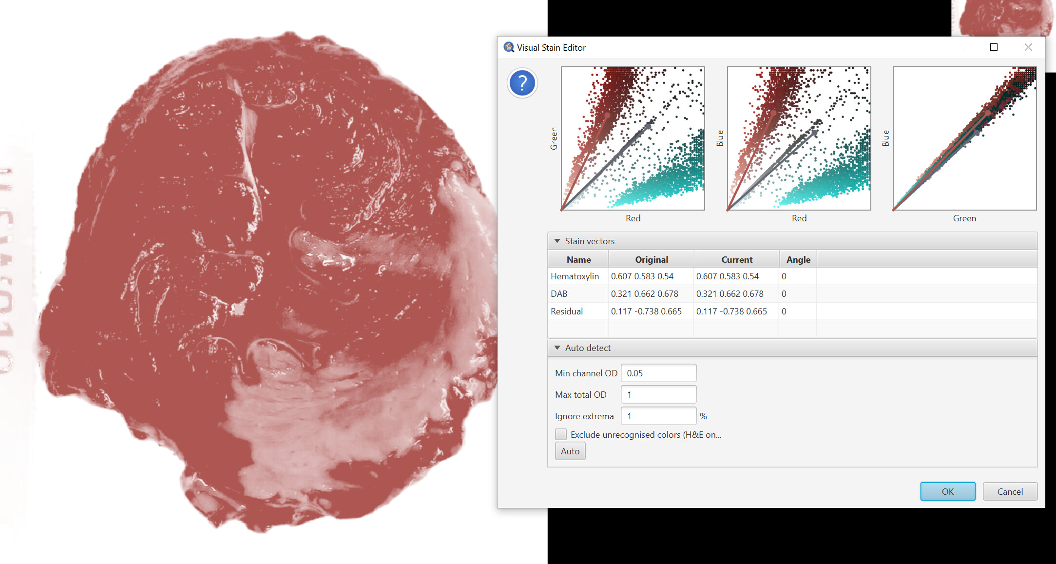 Using QuPath for whole tissue photo analysis - Usage & Issues - Image ...