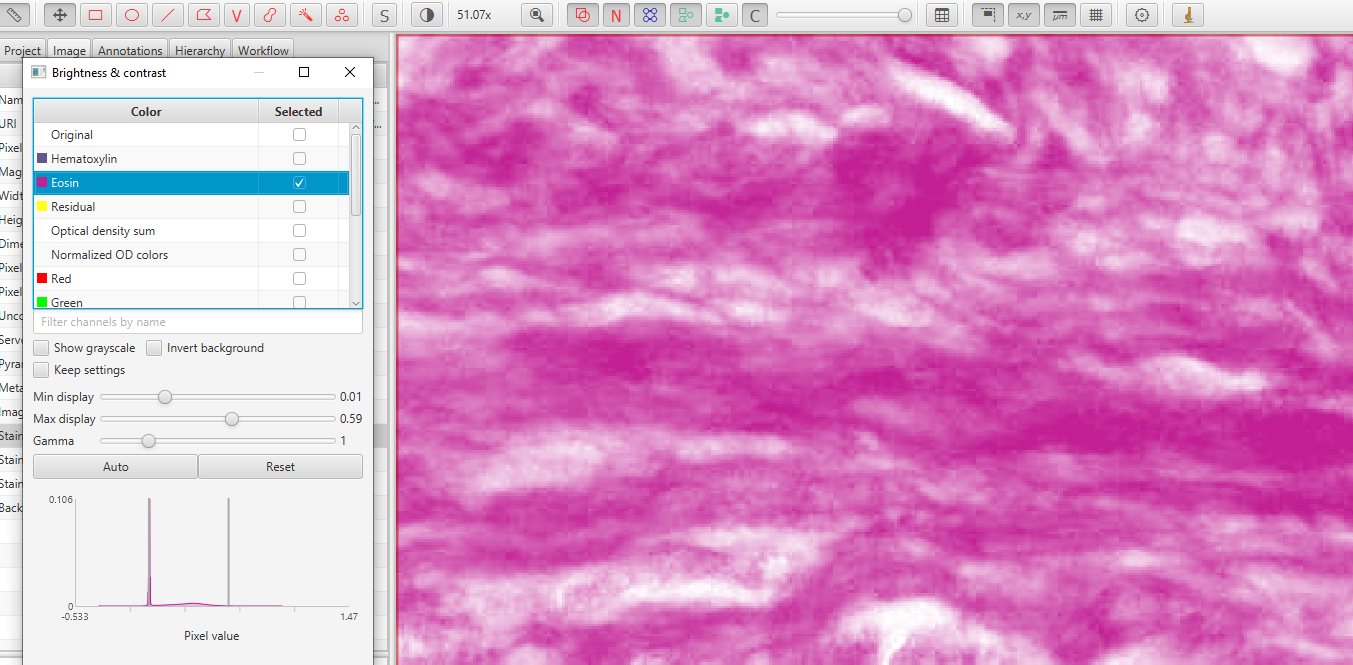 Saffron staining analysis with quPath (histology tissues) - Usage & Issues - Image.sc Forum