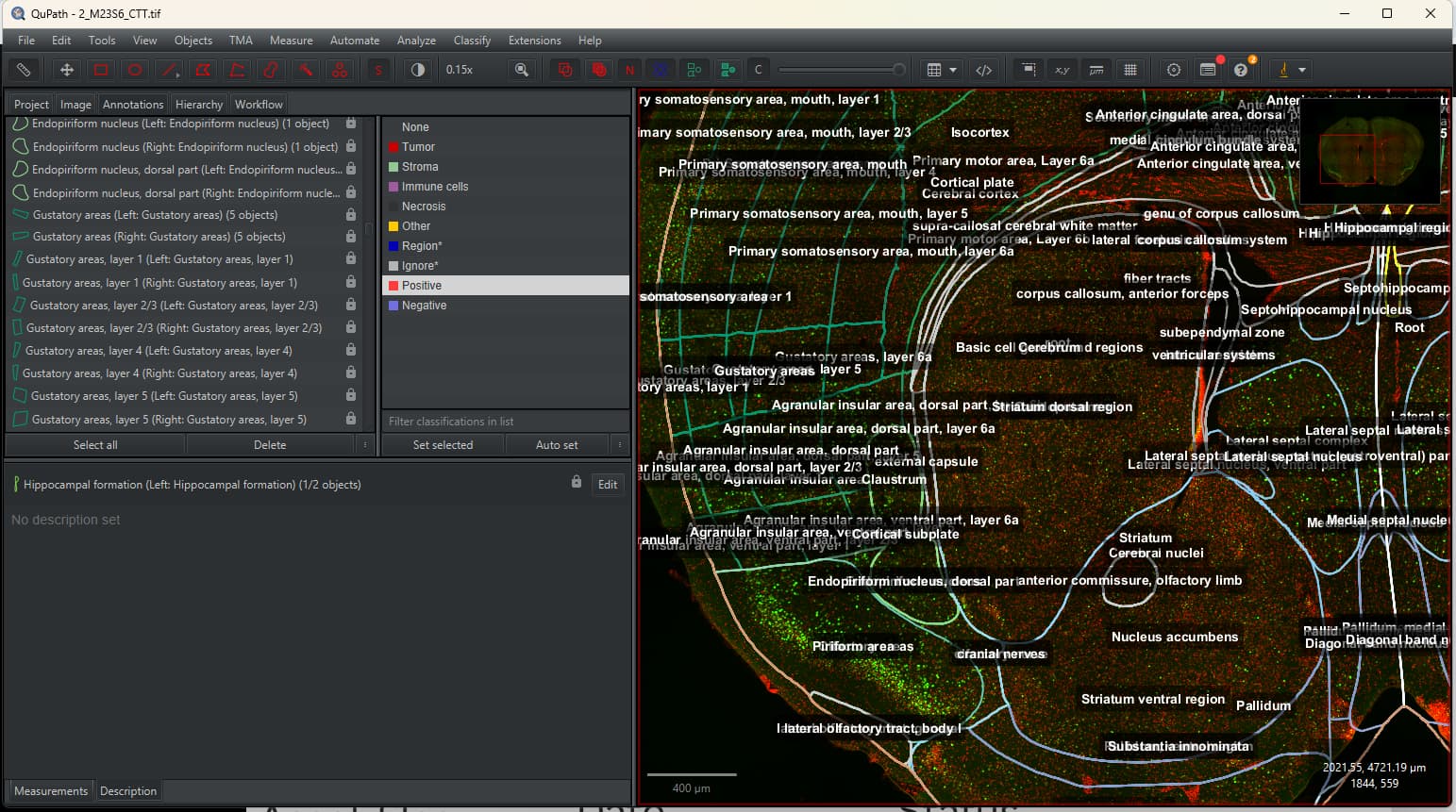 Running StarDist Nuclei Detection on ABBA -registered mouse brain Images in QuPath - Image ...