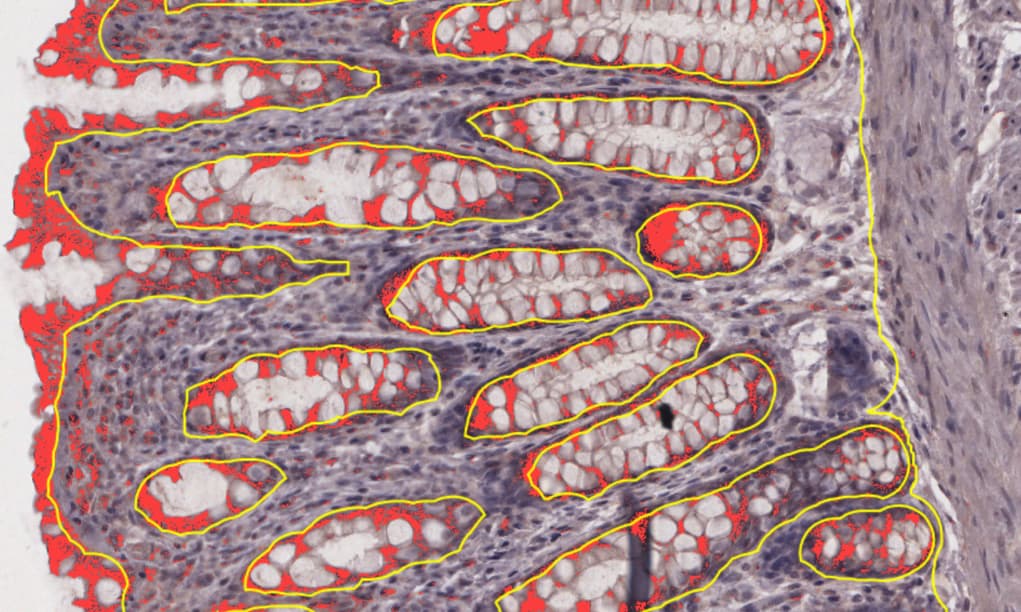 Help: Using CellProfiler for IHC tissue analysis - Image Analysis - Image.sc Forum