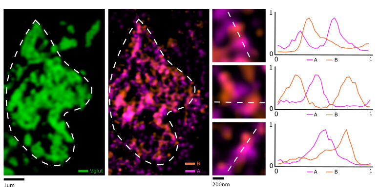 Analyzing Super-Resolution, SIM^2 Processed Images - Help! - Image ...