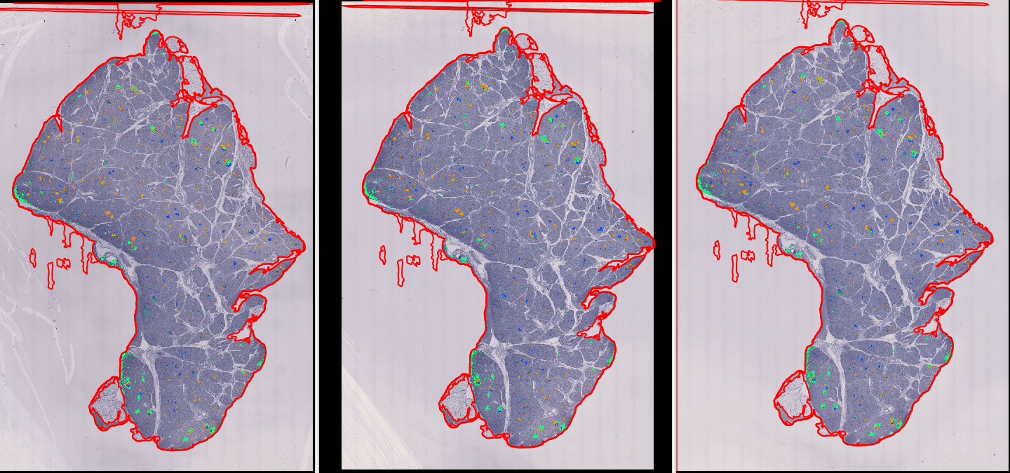 QuPath- Multiple Image Alignment and Object Transfer - Image Analysis - Image.sc Forum