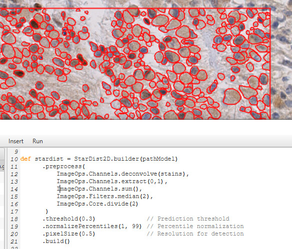 Universal StarDist for QuPath - Transfer Pretrained Models Across Modalities With Ease ...