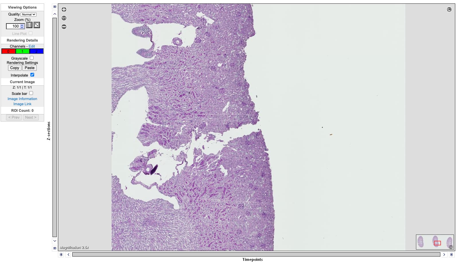 NDPIs don't load fully in OMERO viewer after update to OMERO.server 5.6.14 - Usage & Issues ...