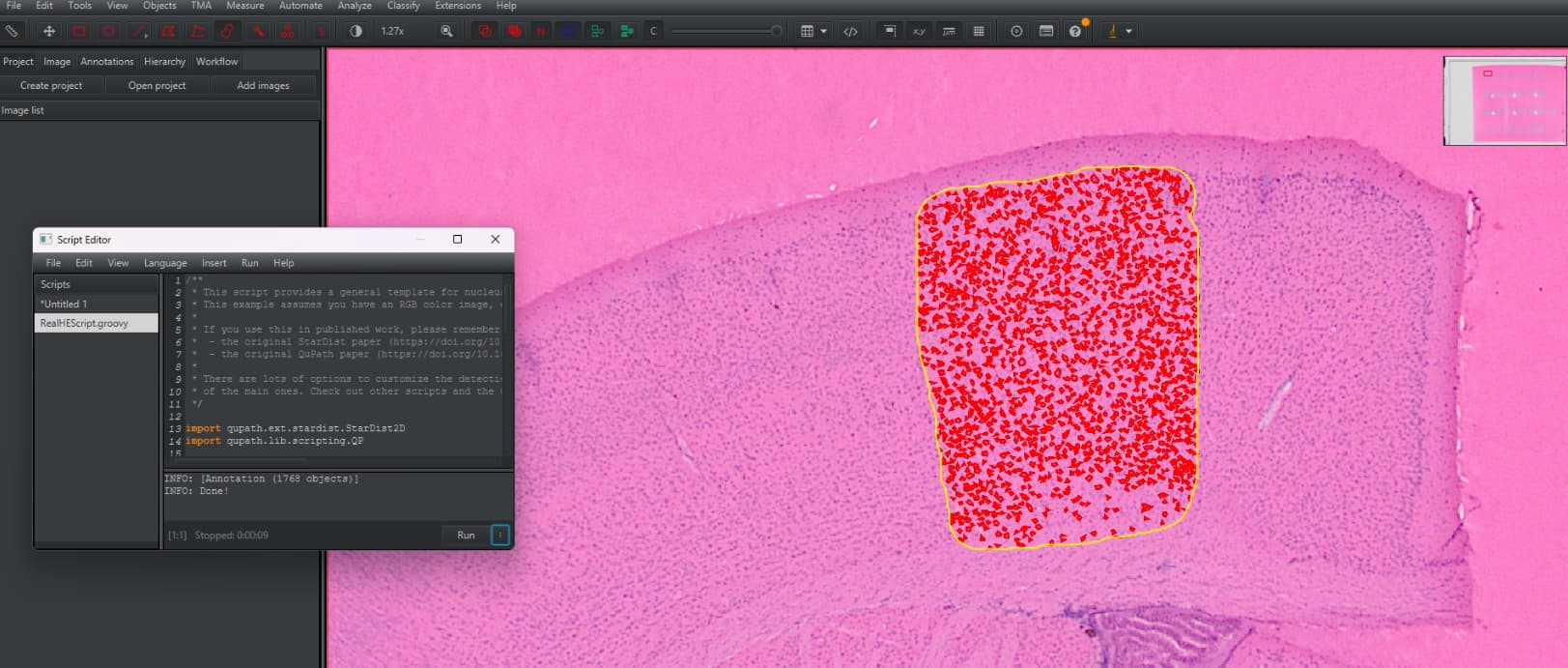 QuPath StarDist Extension - H&E Nuclei counting Improvement - Image Analysis - Image.sc Forum