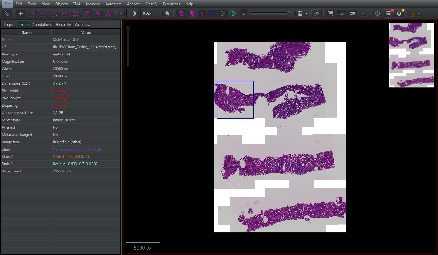 Export annotations from QuPath to napari - Image Analysis - Image.sc Forum