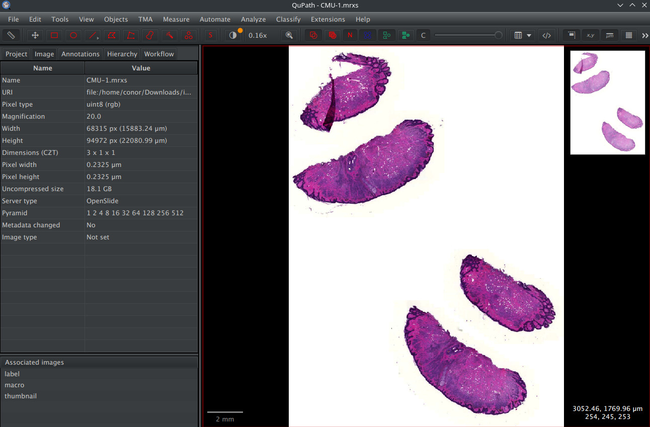 Same issue opening mrxs in Linux (Ubuntu) for QuPath 0.5.1 - Usage ...
