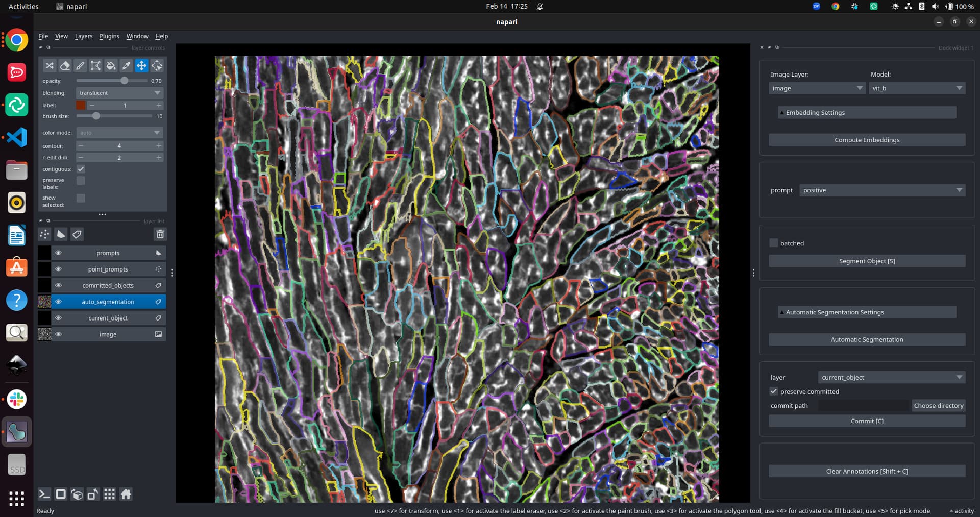 Segment cells with different shapes with Cellpose - Image Analysis - Image.sc Forum
