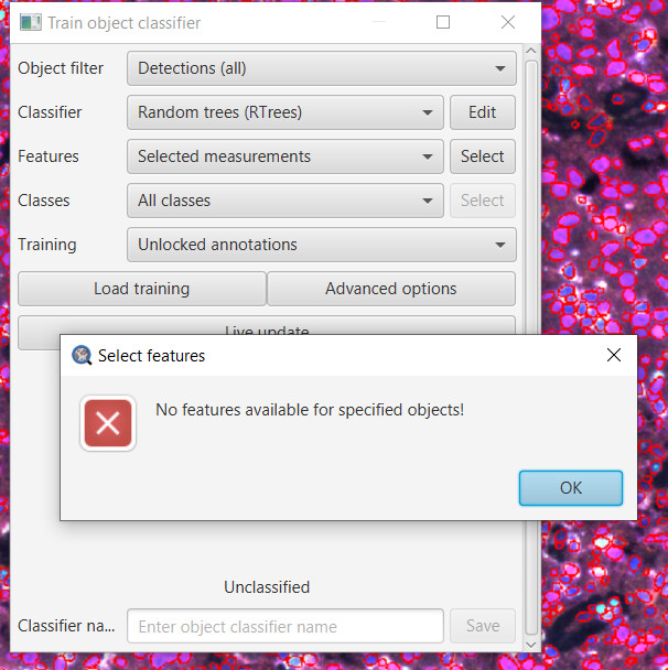 Object classification after nuclear detection with Stardist - Image Analysis - Image.sc Forum