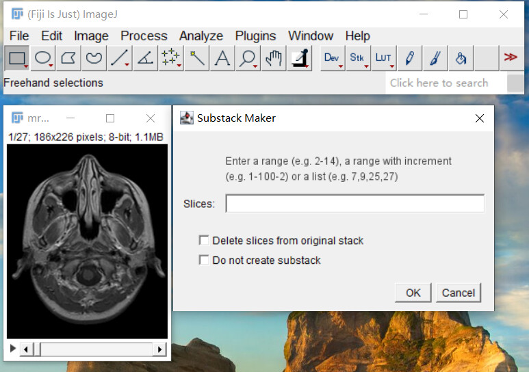 Bug for "Make substack..." - Image Analysis - Image.sc Forum