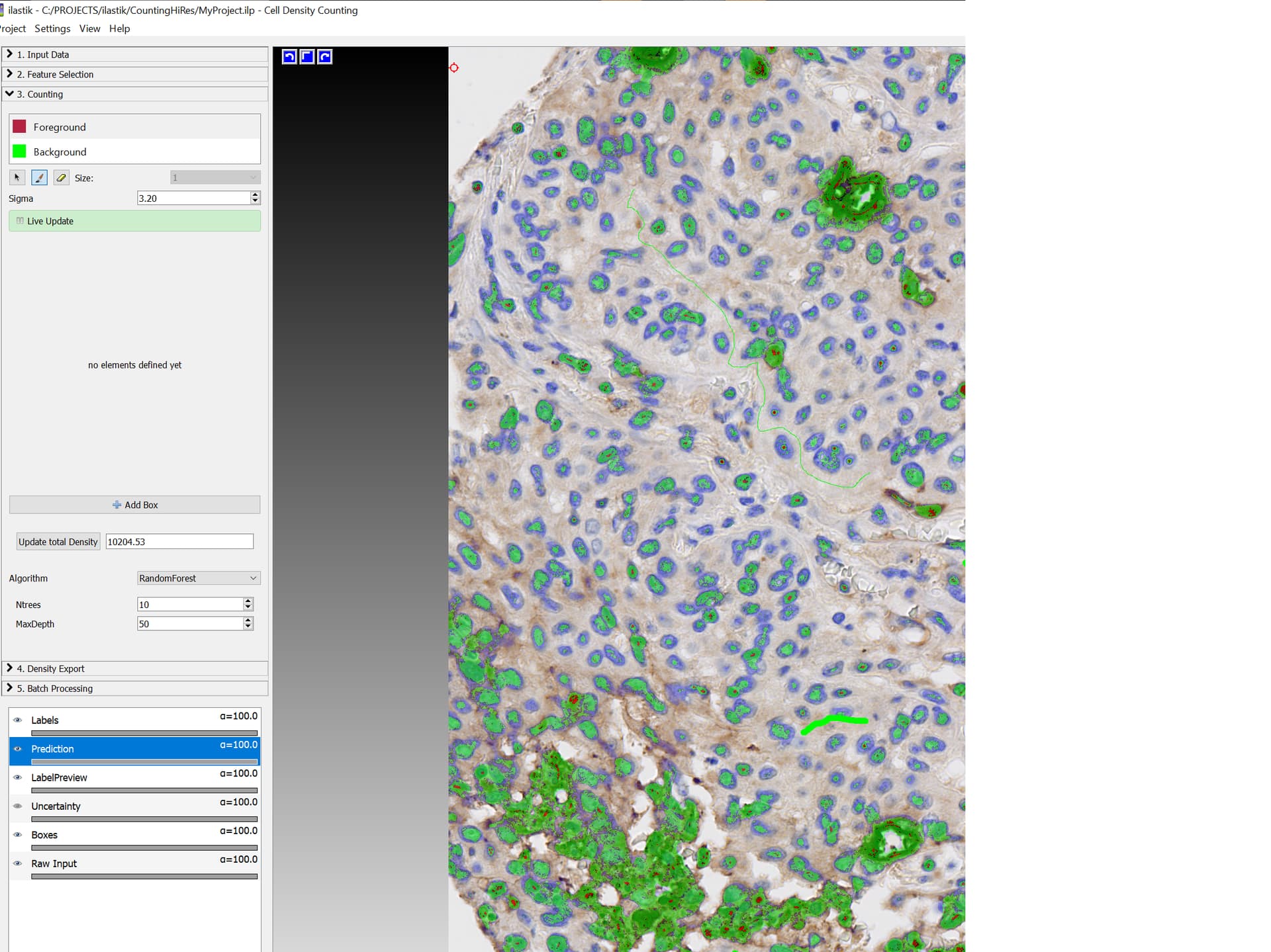Problem with cell density counting on a tissue slice image - Image Analysis - Image.sc Forum