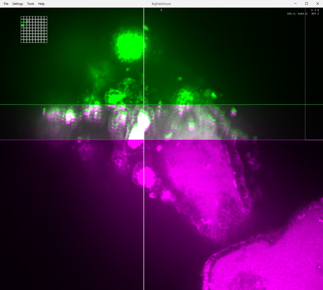 Bigstitcher global optimization problem - Usage & Issues - Image.sc Forum