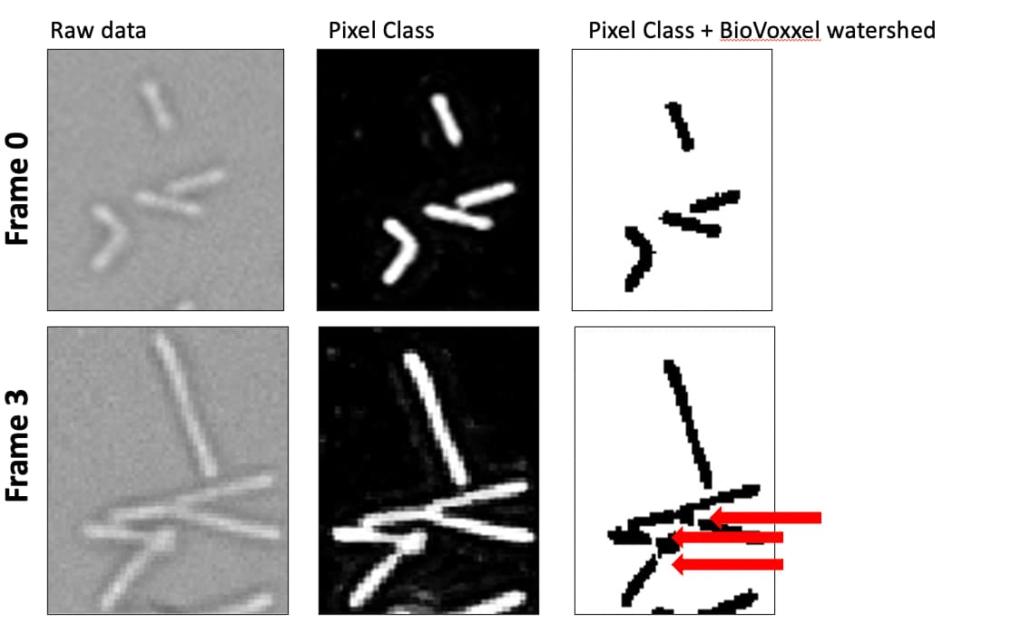 Optimising Ilastik Pixel classification output (via watershedding?) - Image Analysis - Image.sc ...