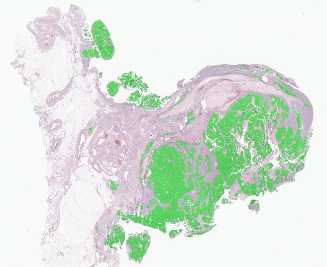 Question about converting fastpathology segmentation file for importing to QuPath - Usage ...