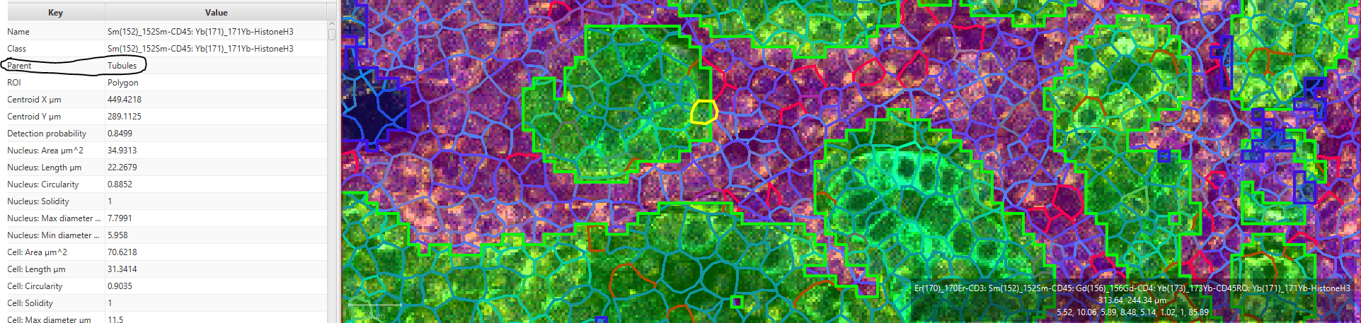 QuPath-Run Stardist on annotations created by tissue classifier - Image Analysis - Image.sc Forum