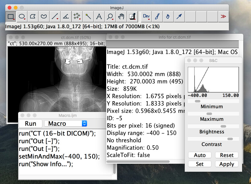 Correcting a signed 16-bit grayscale image to exact signed 16-bit ...
