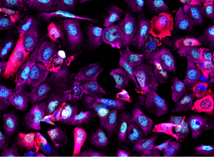 How can I use for 4 channel colocalization visualization - Image ...